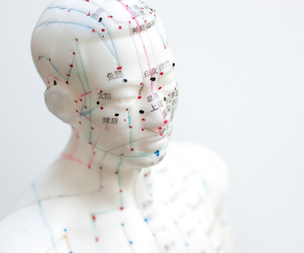 Hvad er Akupunktur - Læs om mulighederne for behandling